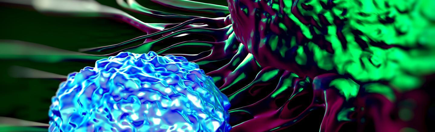 Build a Successful Outpatient CAR T Cell Therapy Program